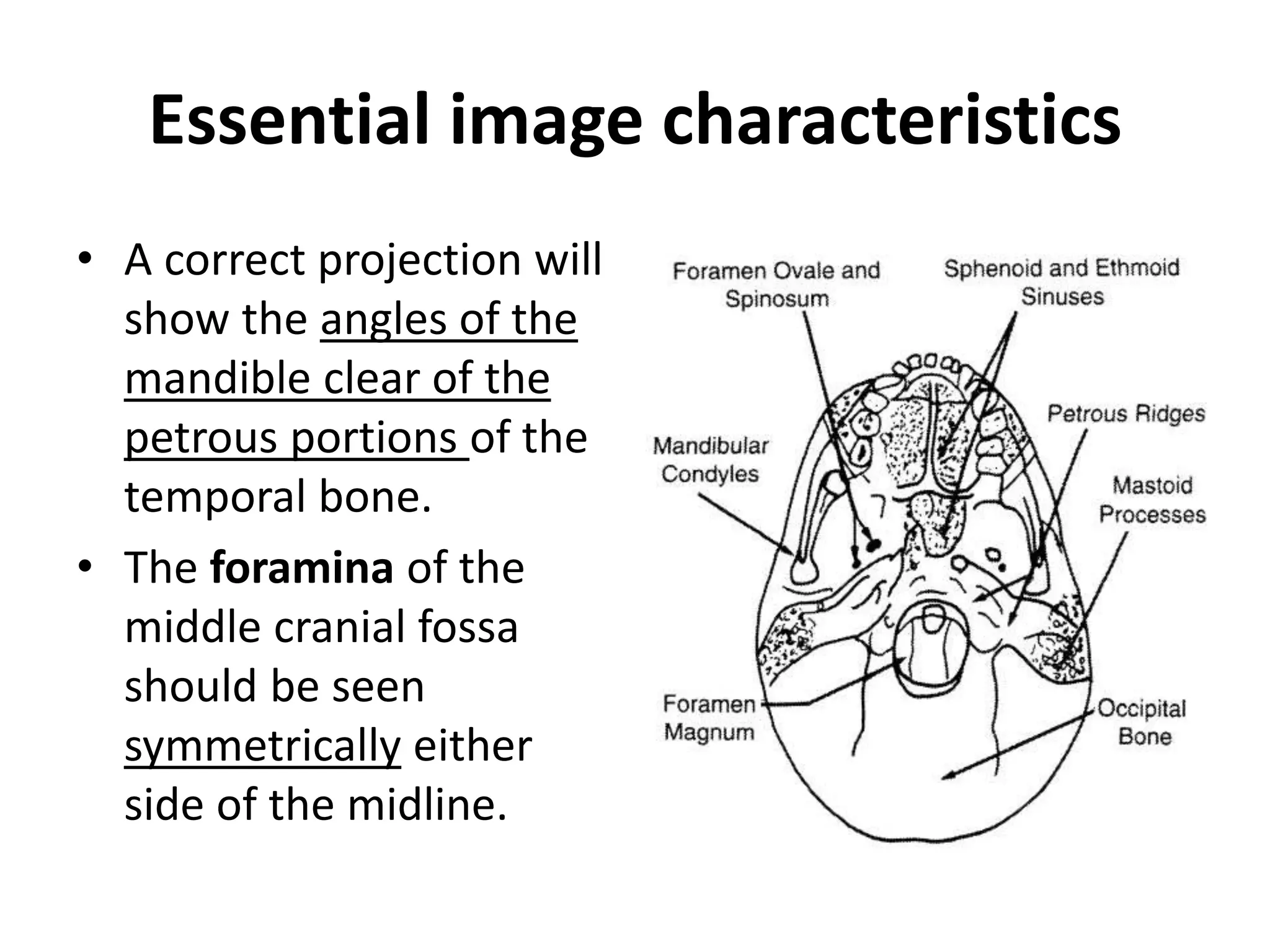 Imaging in Skull base | PPTX
