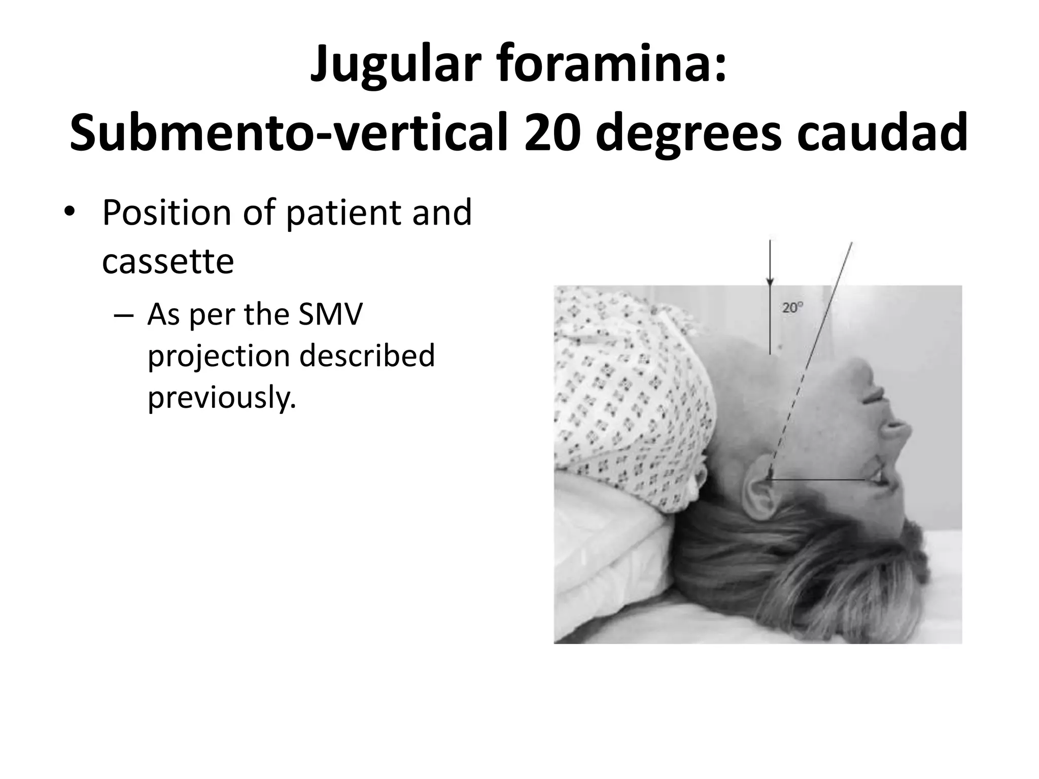 Imaging in Skull base | PPTX