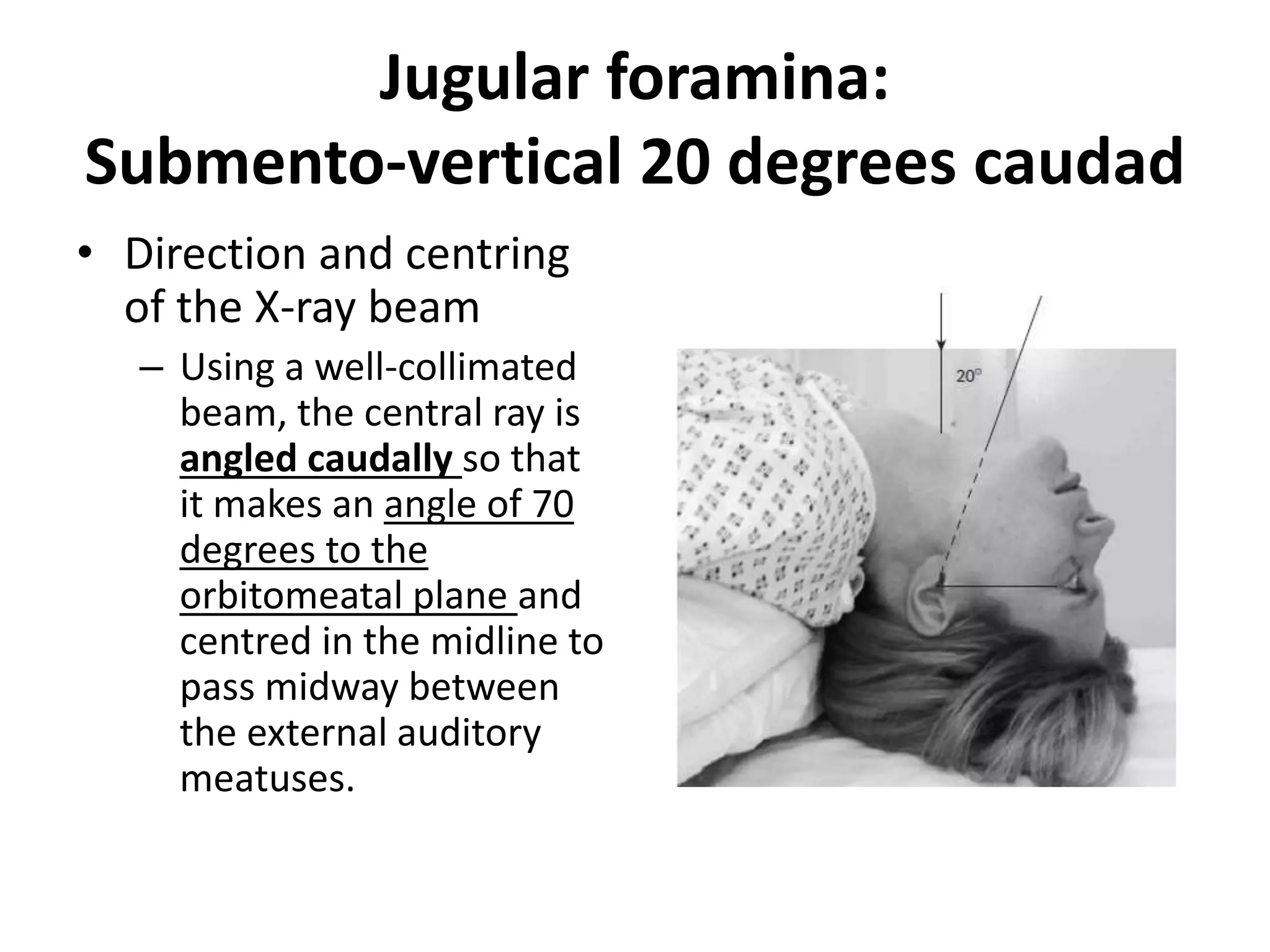 Imaging in Skull base | PPTX