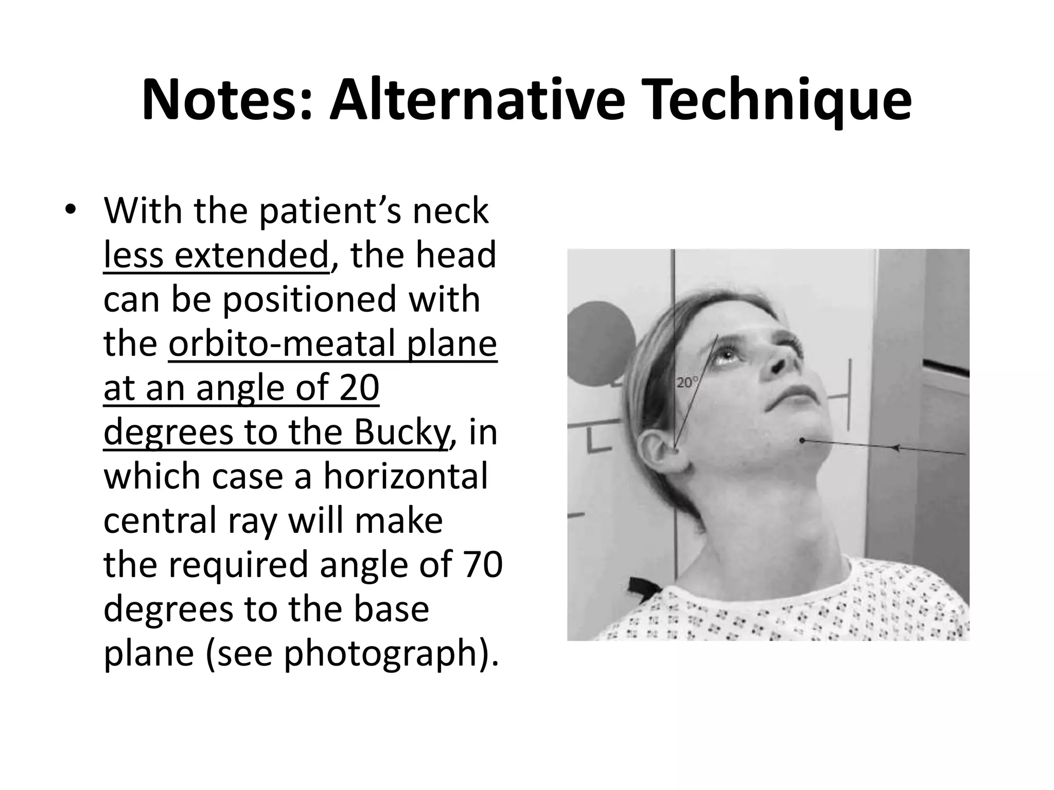 Imaging in Skull base | PPTX