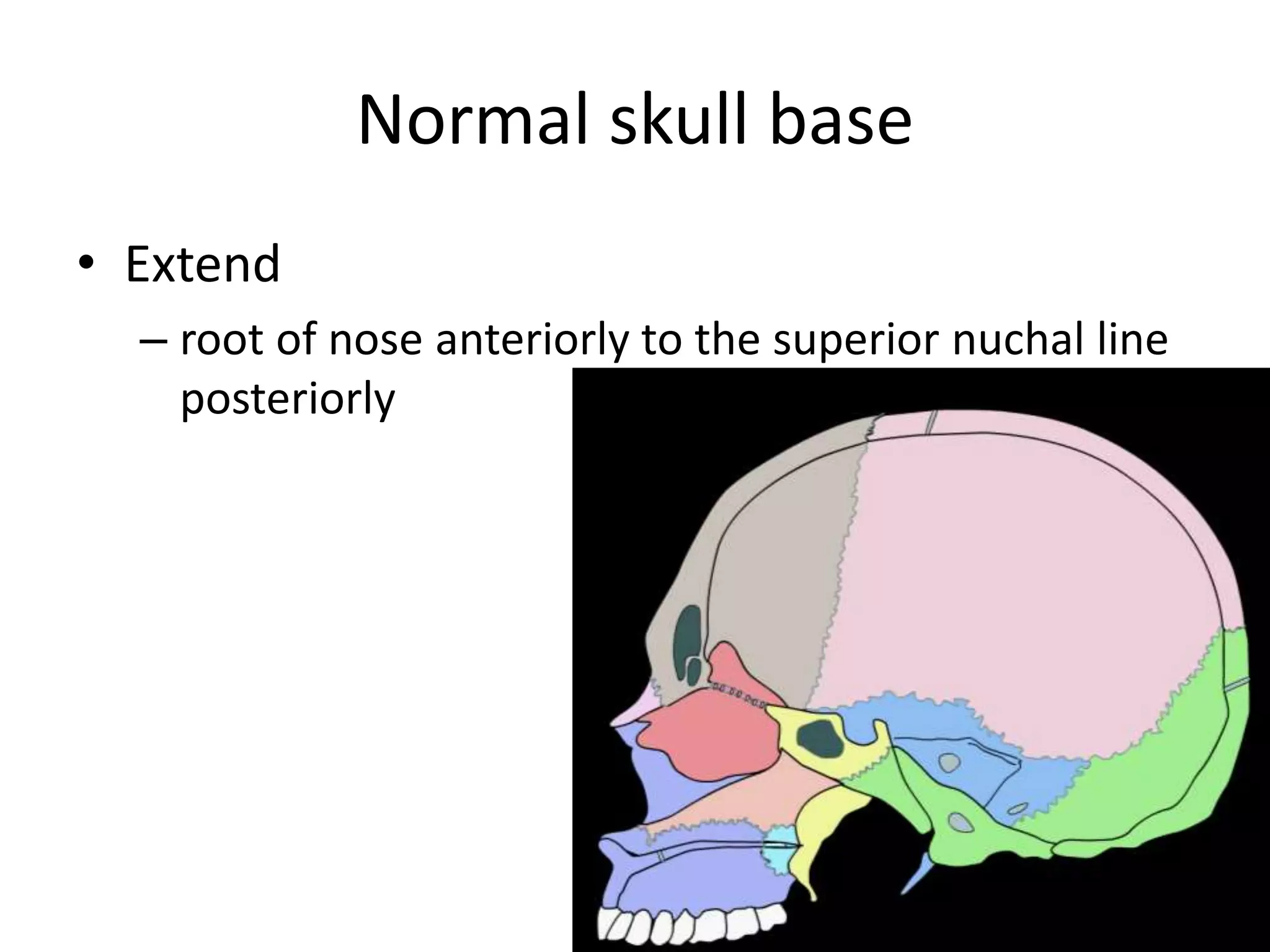 Imaging in Skull base | PPTX