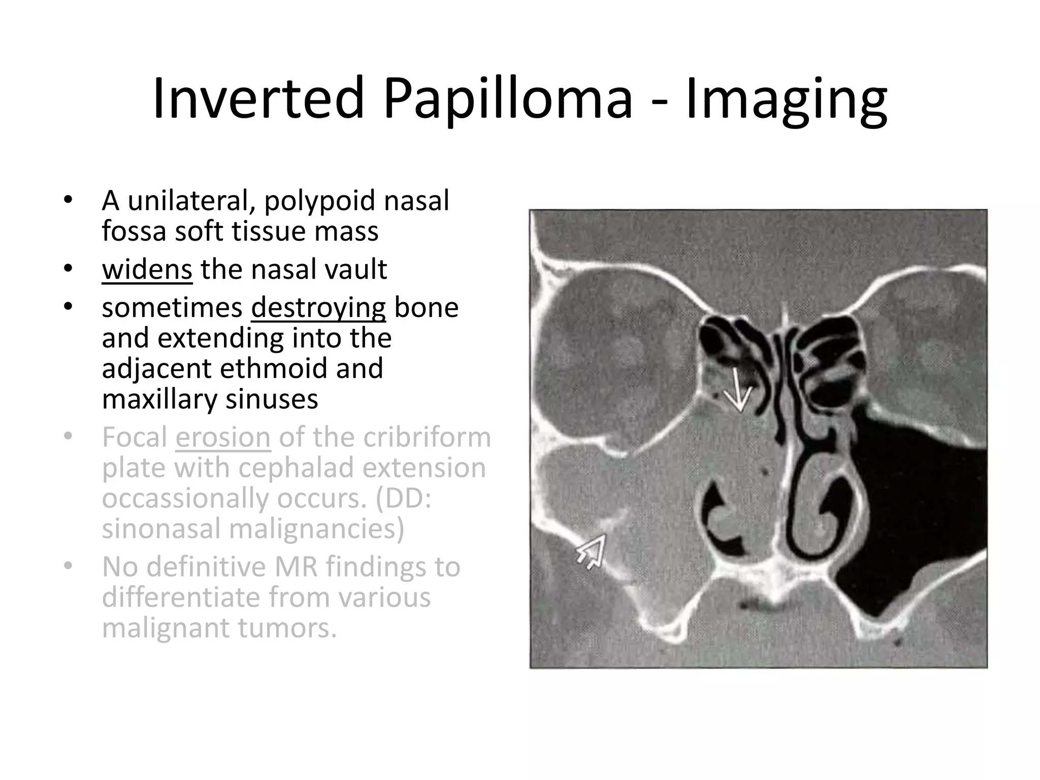 Imaging in Skull base | PPTX