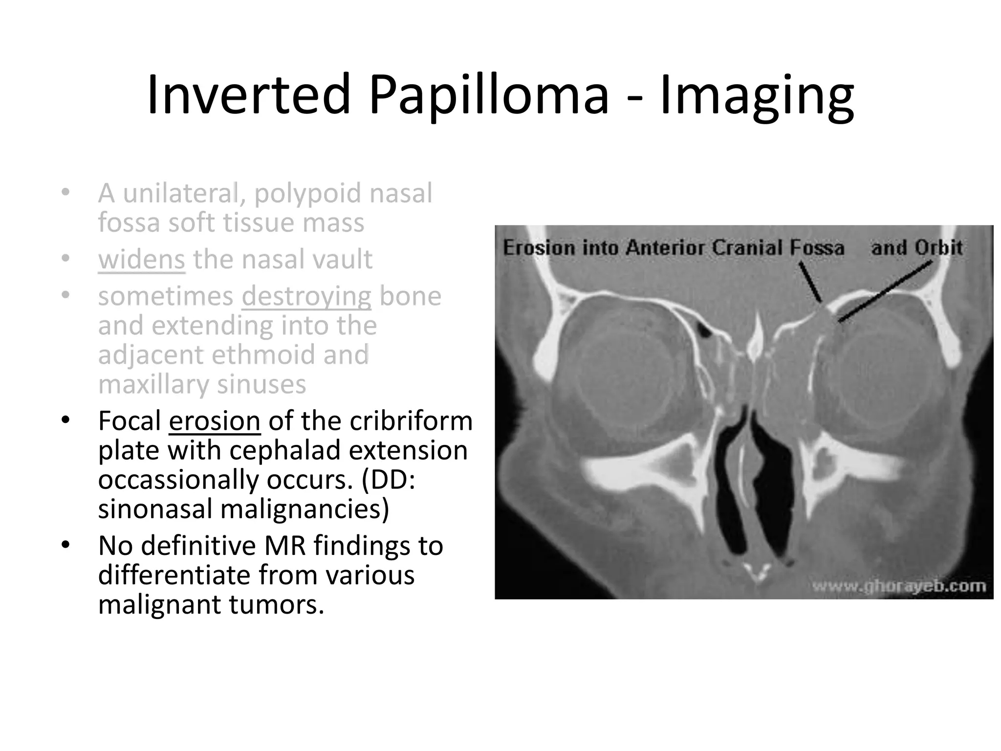 Imaging in Skull base | PPTX