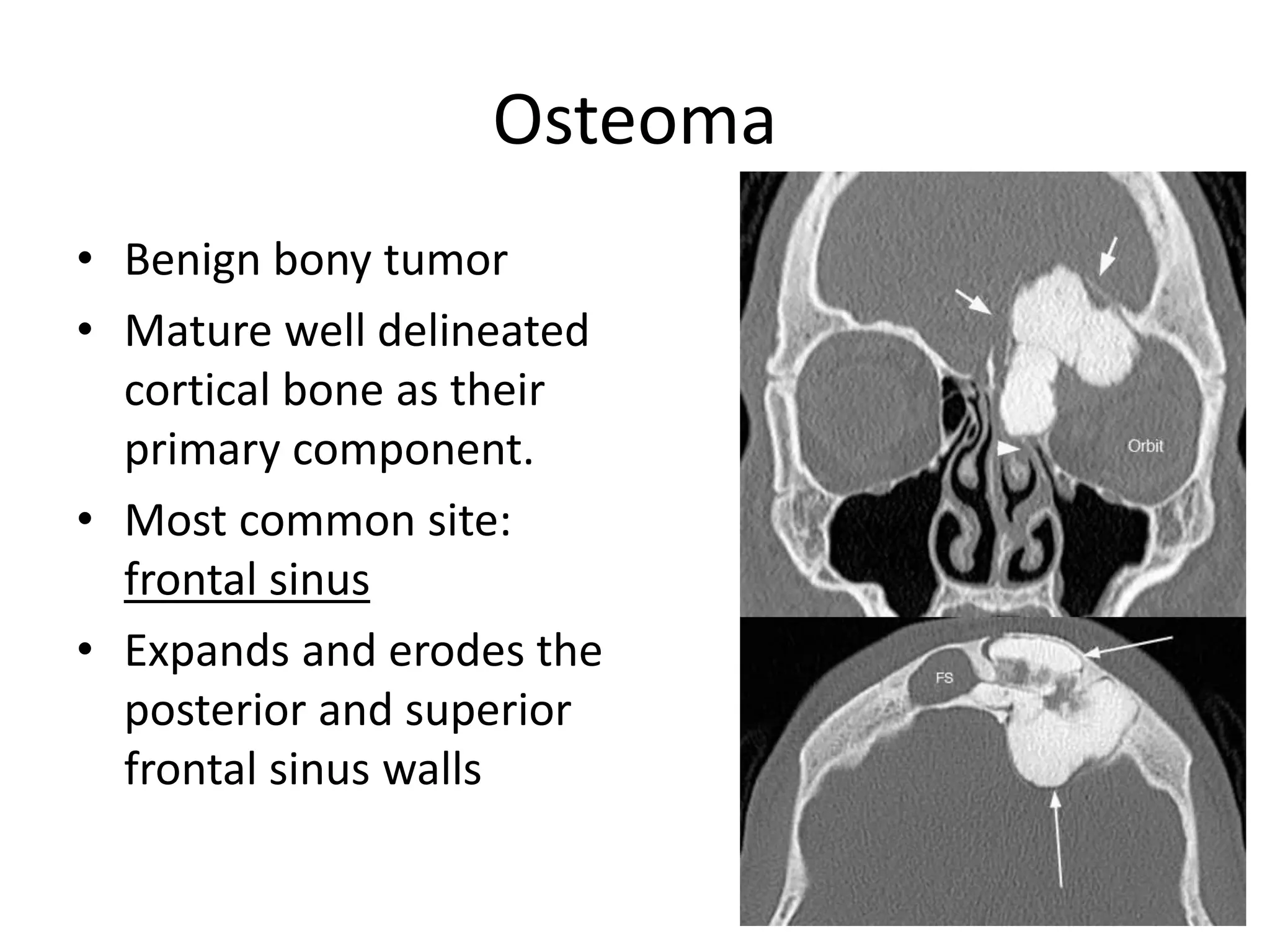 Imaging in Skull base | PPTX