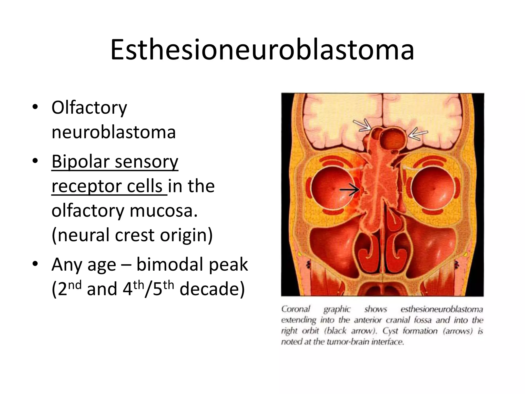 Imaging in Skull base | PPTX