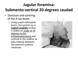 Imaging in Skull base | PPTX
