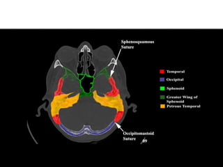 Skull Base Anatomy