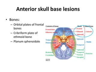 Anterior Skull Base Anatomy