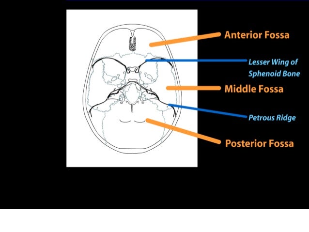 Imaging in Skull base
