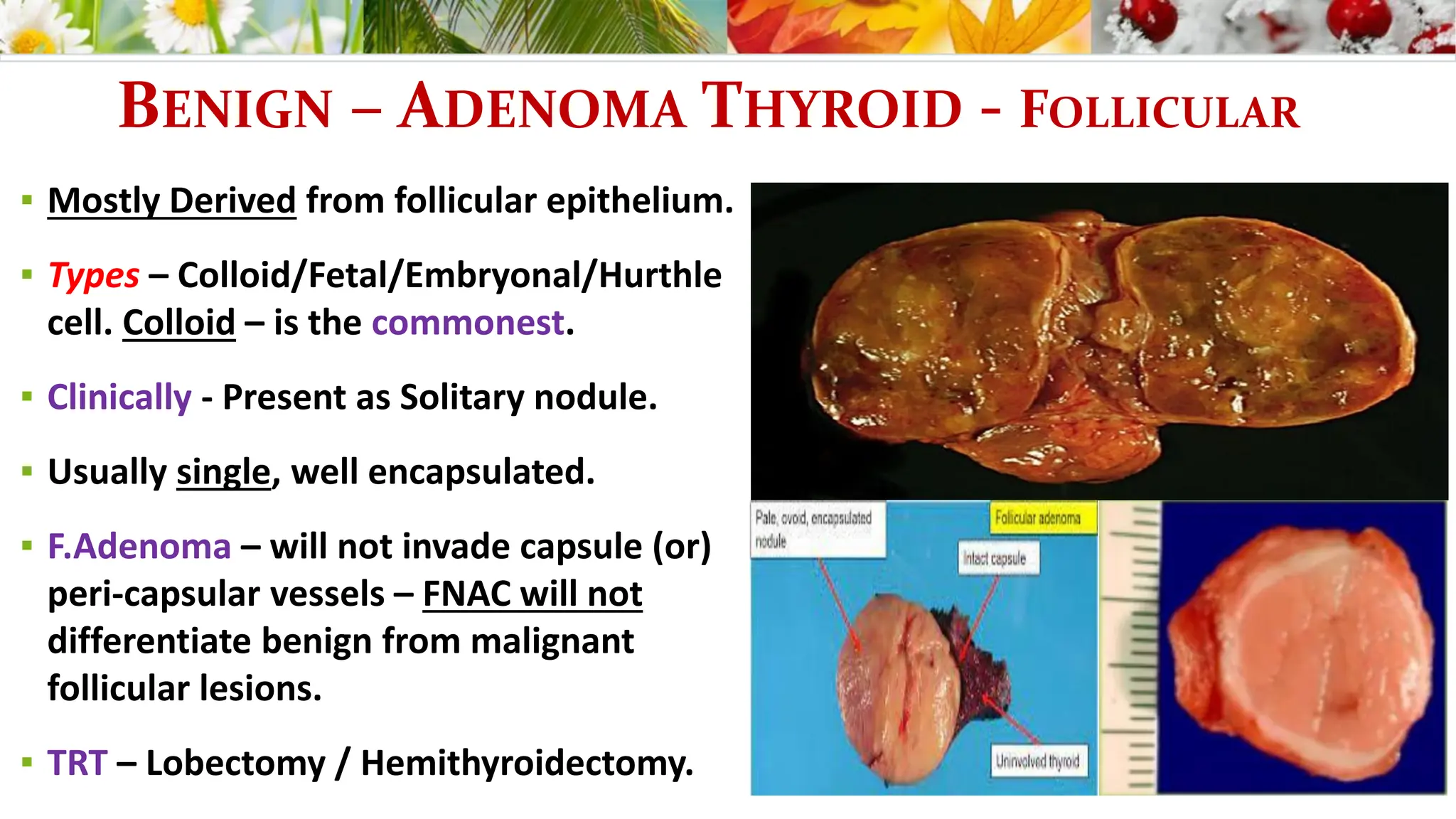 Thyroid Tumours - Malignant & Thyroidectomy | PDF