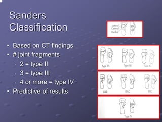 calcaneal fracture | PDF