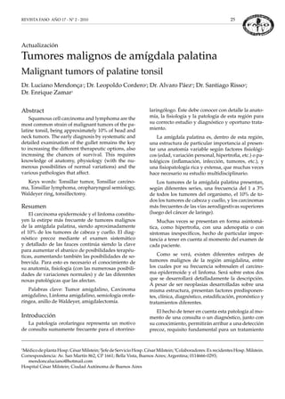 Cancer de amigdala | PDF