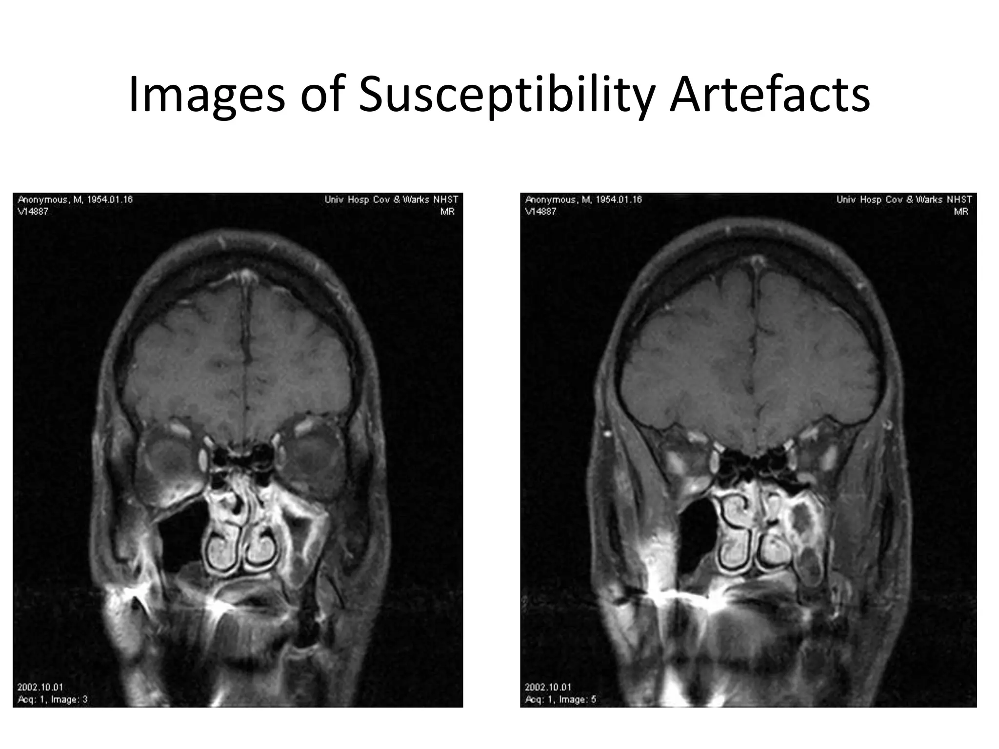 Artefacts mr & ct | PPTX