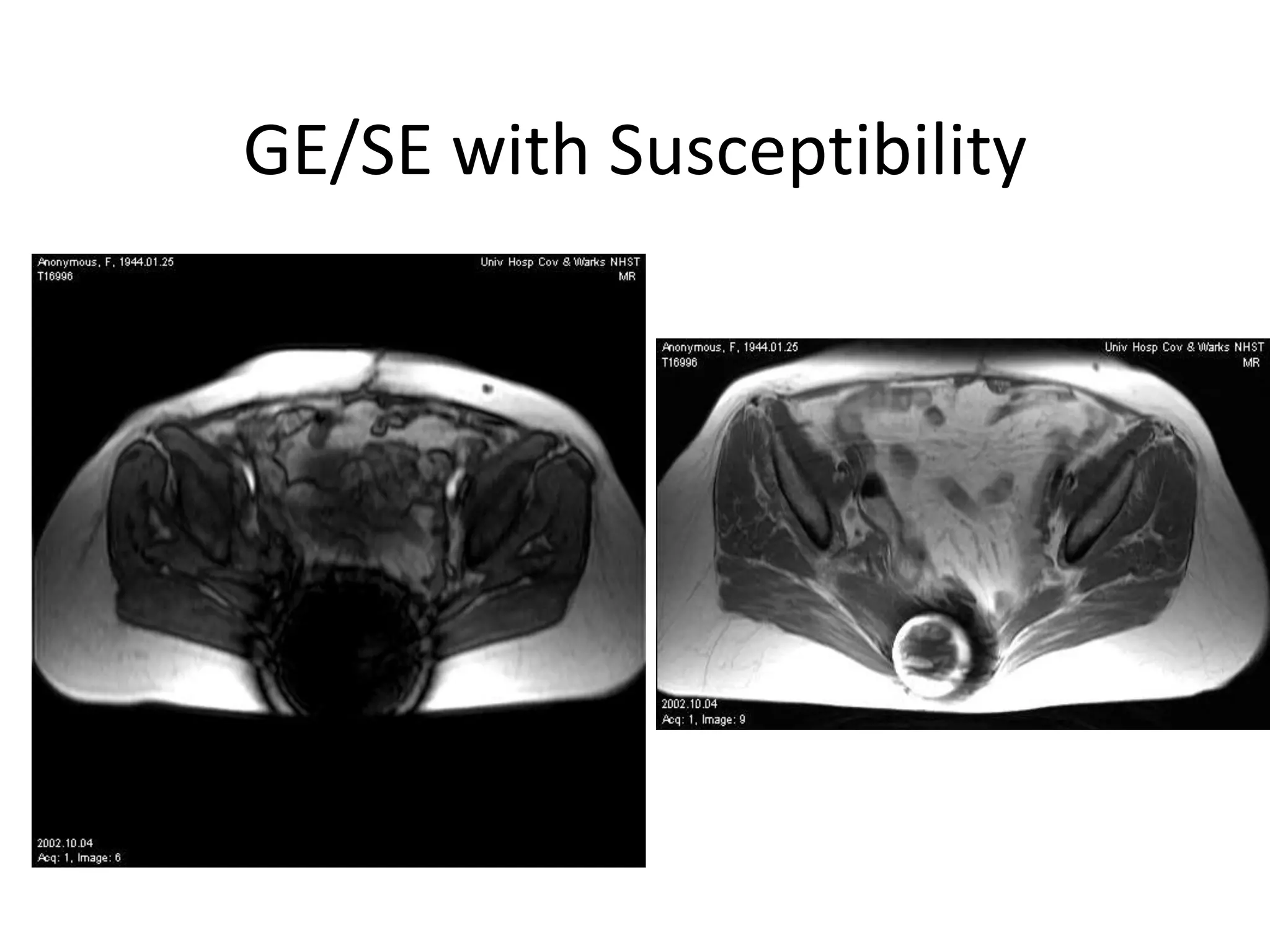 Artefacts mr & ct | PPTX