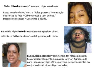 Cabeca e pescoço - EDITADO - aula para enfermagem | PPT