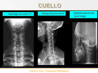 Cabeza cuello normal | PPTX