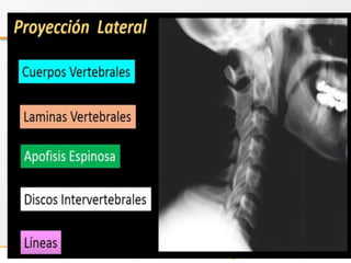 Cabeza cuello normal | PPTX
