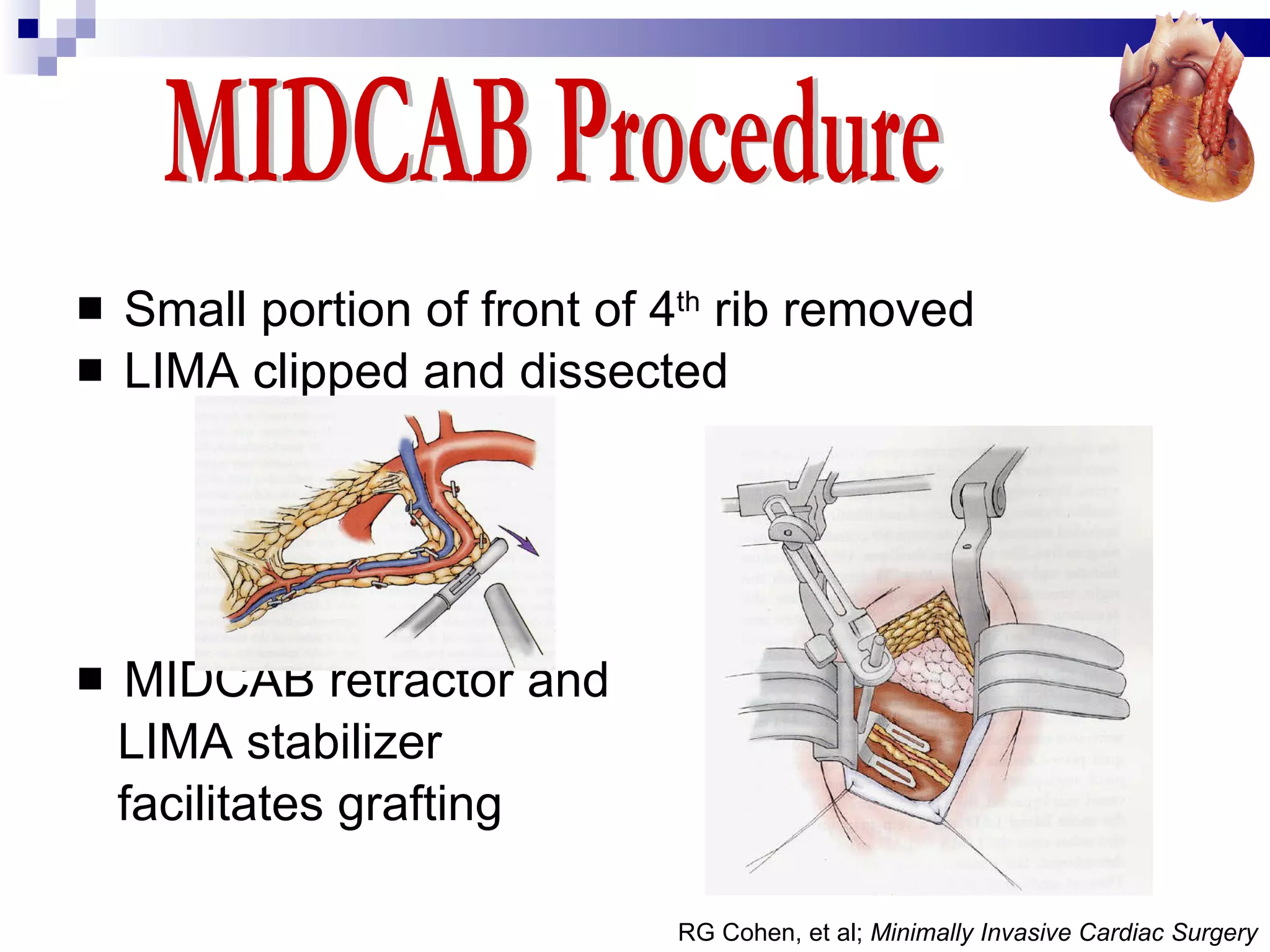 Coronary Artery Bypass Graft (CABG) - Desun Hospital Health Insight | PPT