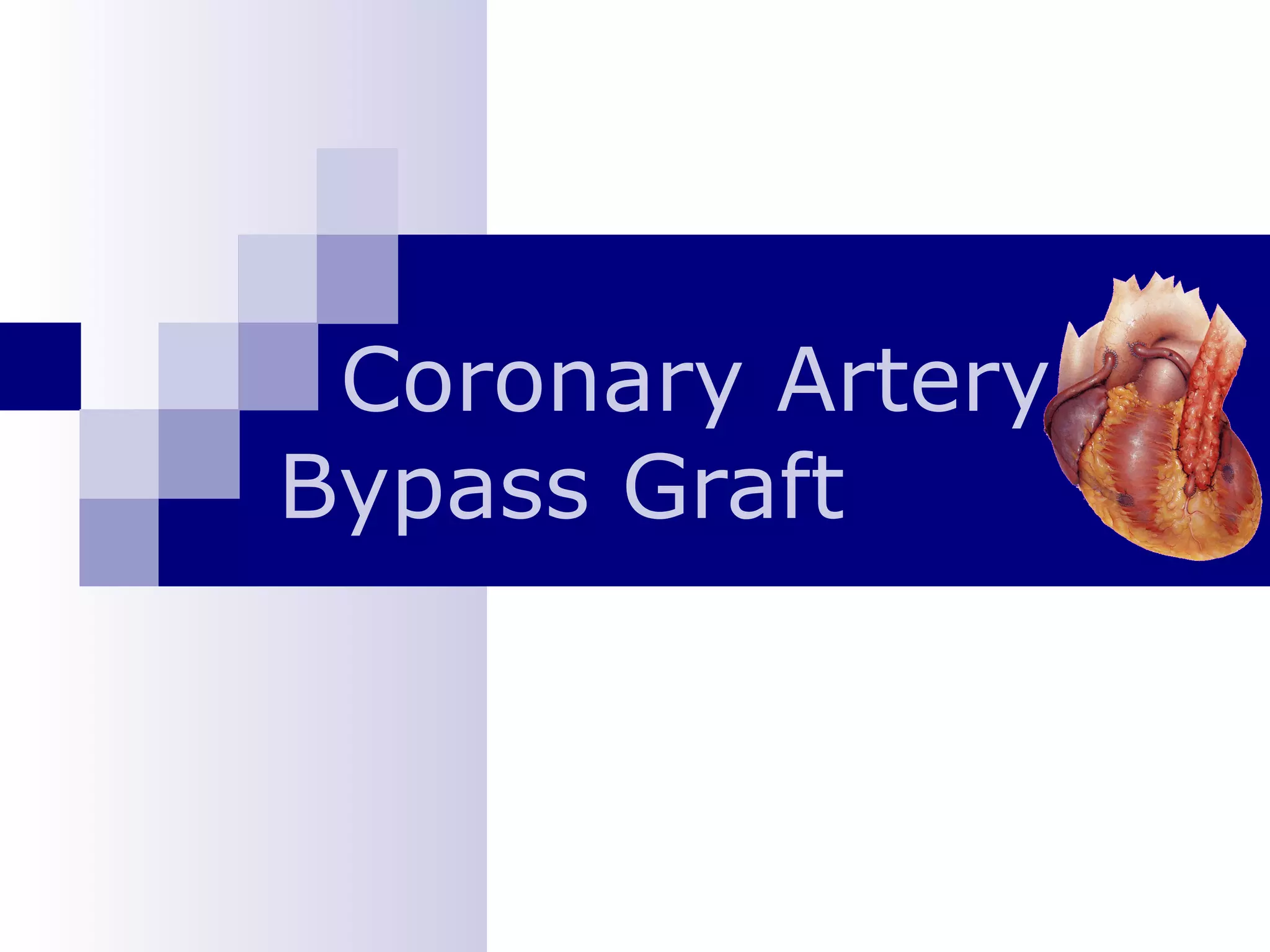 Coronary Artery Bypass Graft (CABG) - Desun Hospital Health Insight | PPT