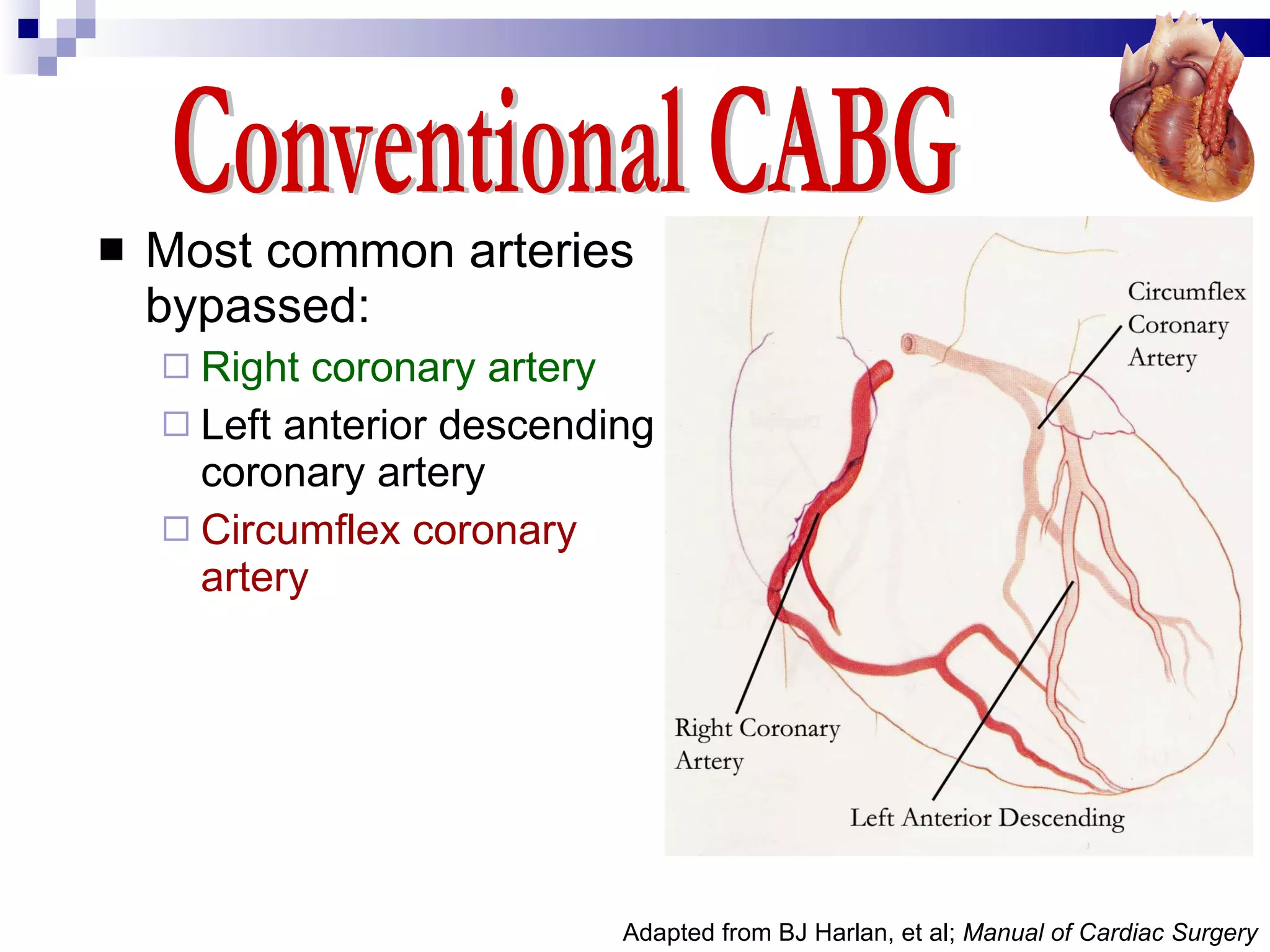 Coronary Artery Bypass Graft (CABG) - Desun Hospital Health Insight | PPT