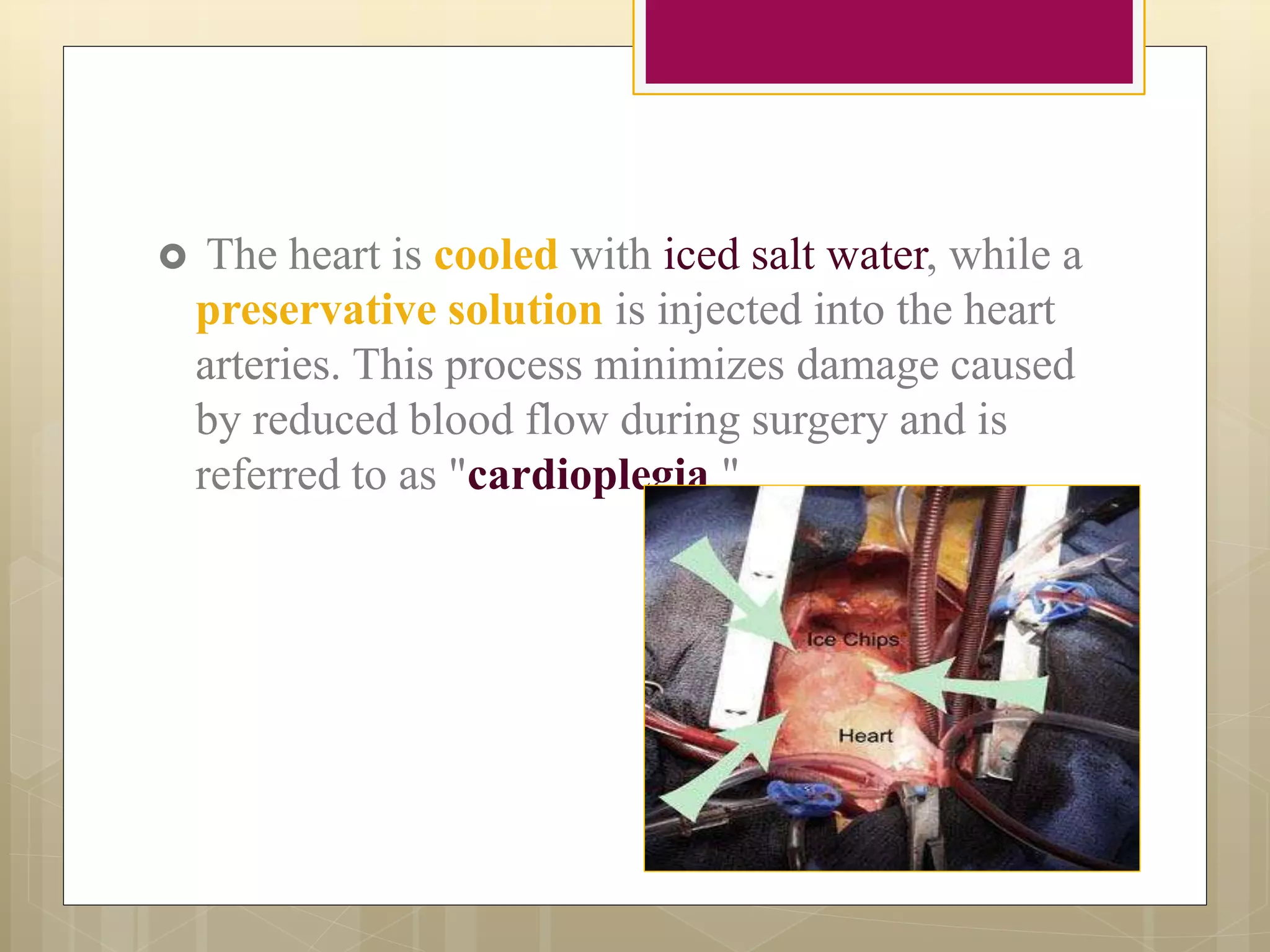 Coronary Artery Bypass Graft | PPTX