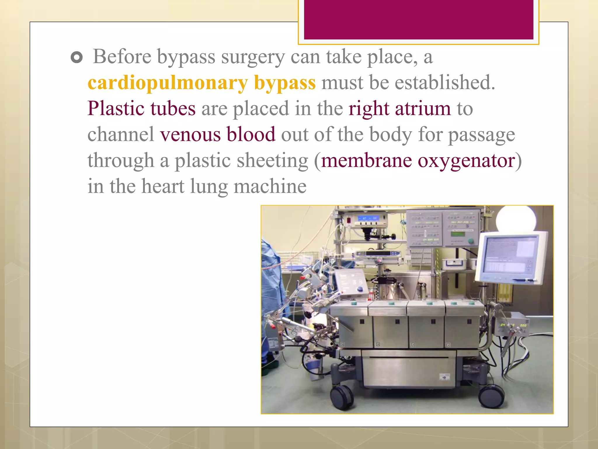 Coronary Artery Bypass Graft | PPTX