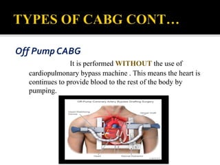 CABG- Coronary Artery Bypass Grafting | PPTX | Heart and Cardiovascular ...