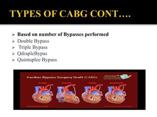 CABG- Coronary Artery Bypass Grafting | PPTX | Heart and Cardiovascular ...
