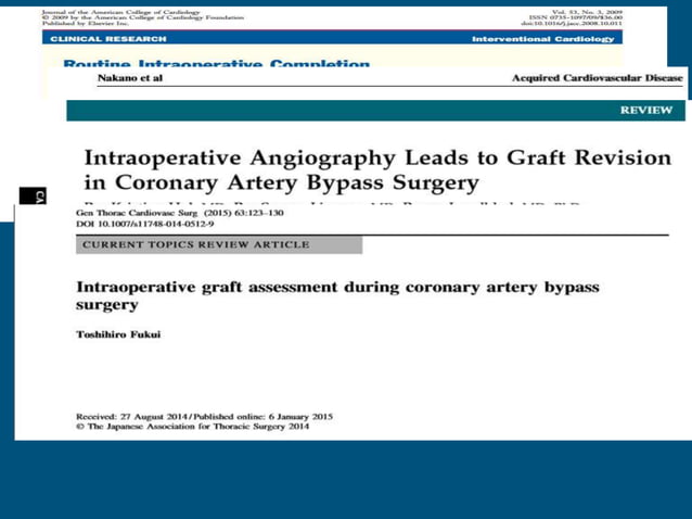 Intraoperative coronary angiography | PPTX