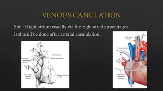Coronary artery bypass grafting for anaesthesiologist | PPTX