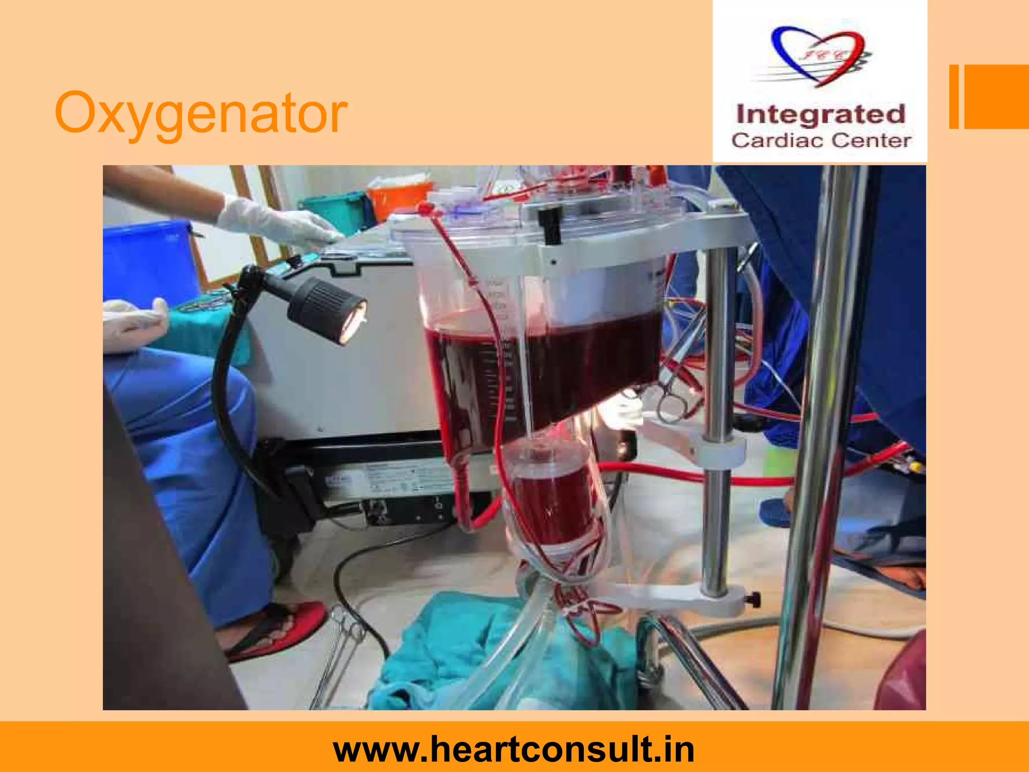 Heart Surgery Coimbatore | Cabg Procedure | POT