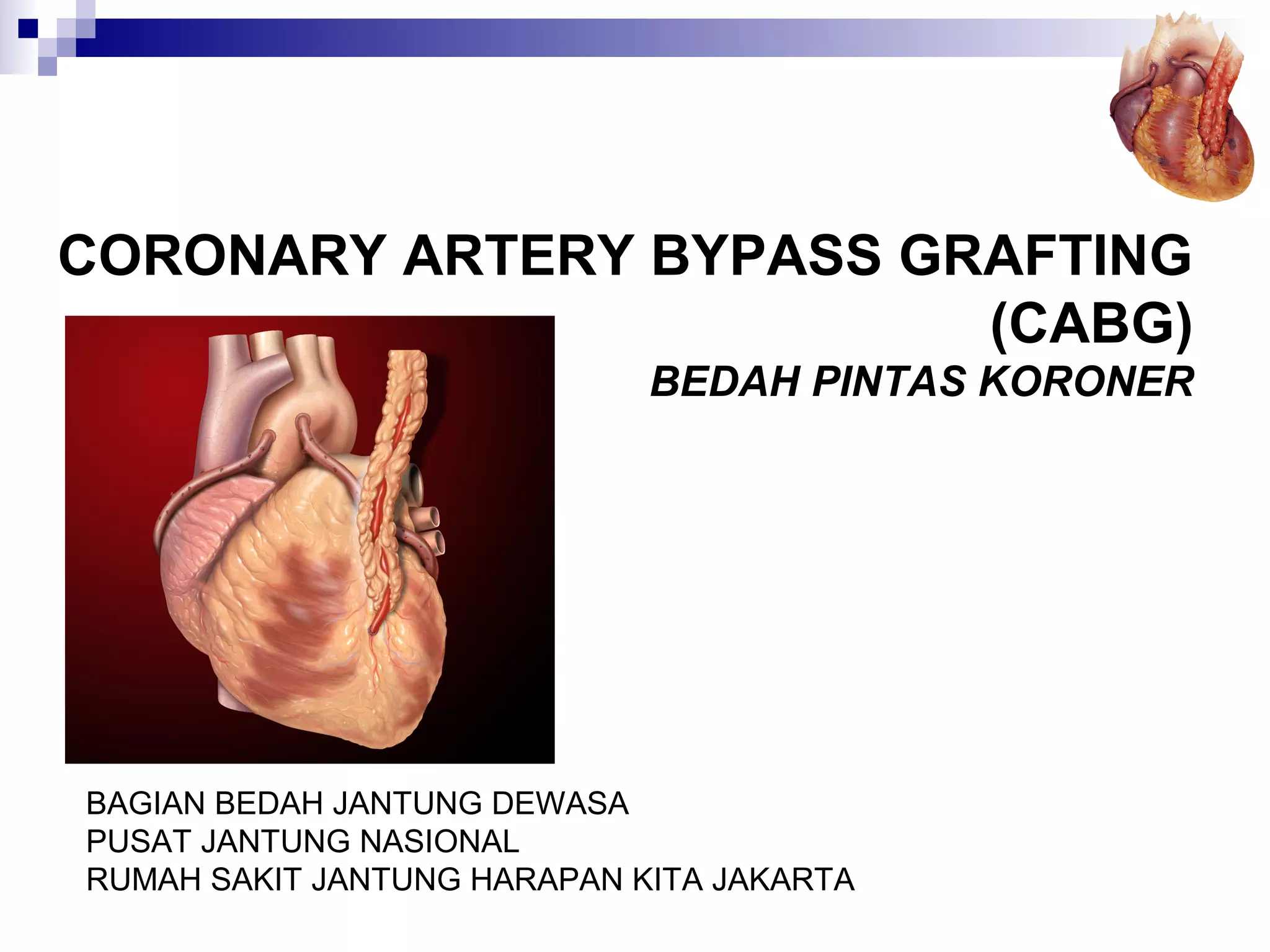 Cabg awam | PPT