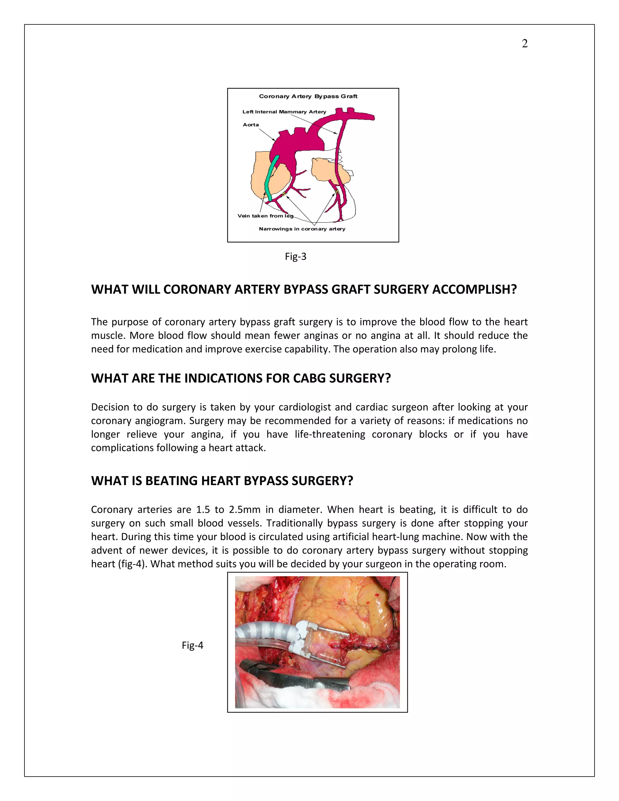 Cabg bypass surgery | PDF