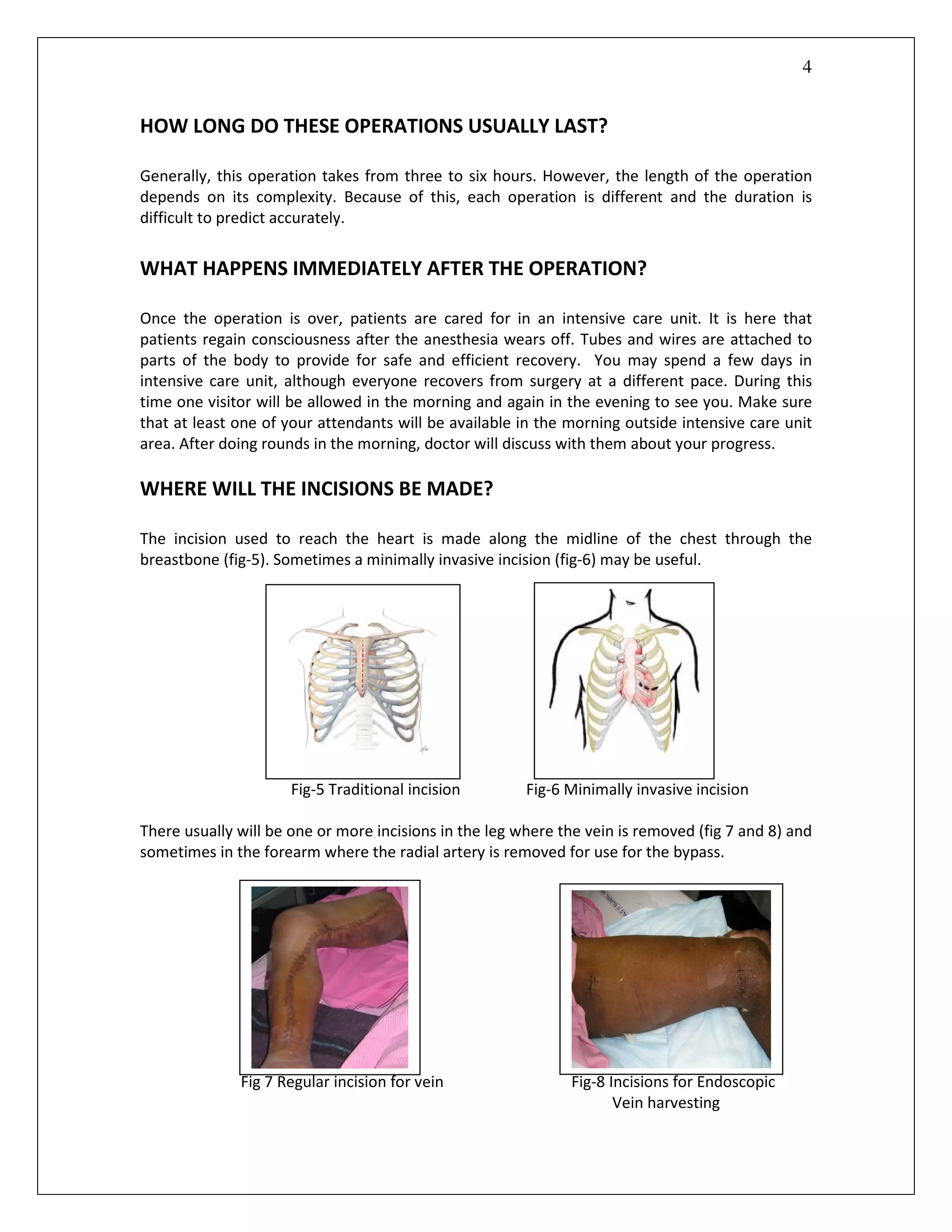 Cabg bypass surgery | PDF