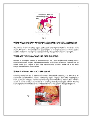Cabg bypass surgery | PDF