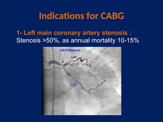 Cardio Pulmonary By Pass Graft (CABG) Indications and how we do it Dr ...