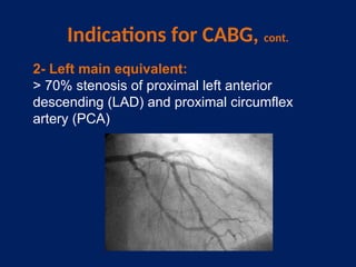 Cardio Pulmonary By Pass Graft (CABG) Indications and how we do it Dr ...