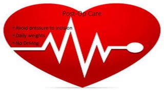 Cabg powerpoint | PPTX
