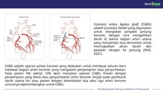 Coronary Artery Bypass Graft PRESENTATION.pptx
