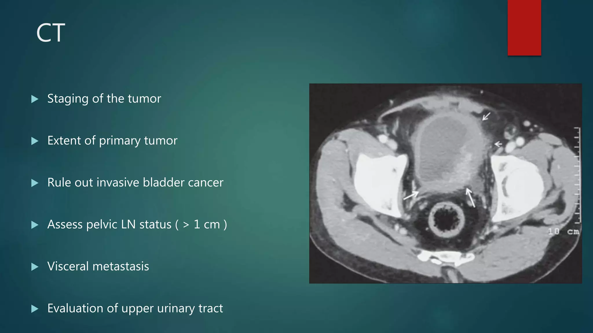 Ca bladder diagnosis | PPT