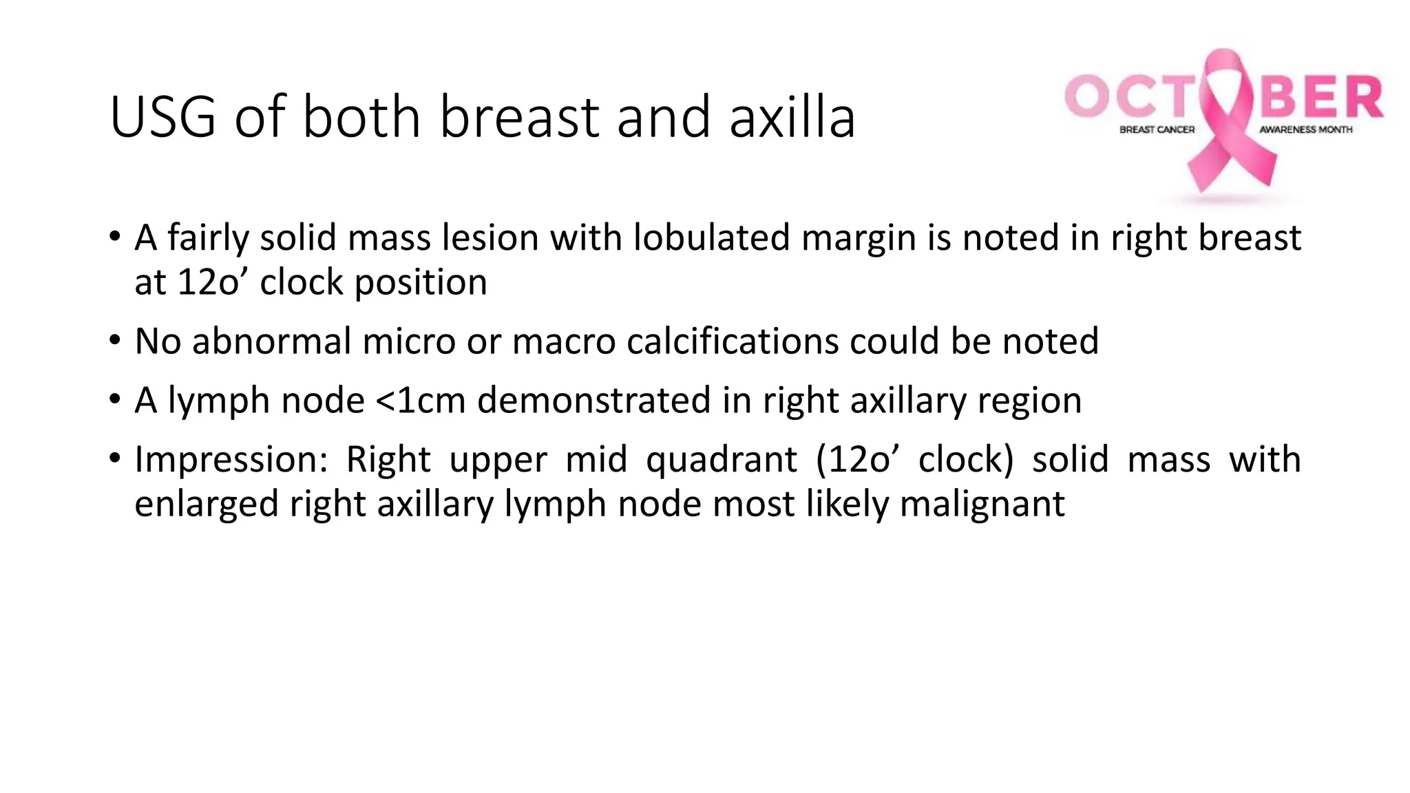 carcinoma breast case presentation .pptx