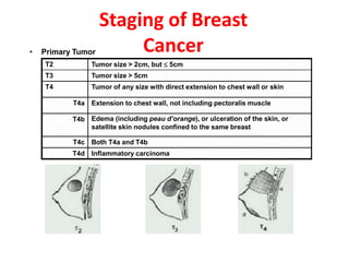 Ca breast ug lecture ajay khanna department of surgery. ims, bhu, varanasu | PPTX