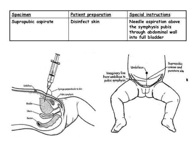 Cabsi cauti-vap-nurses
