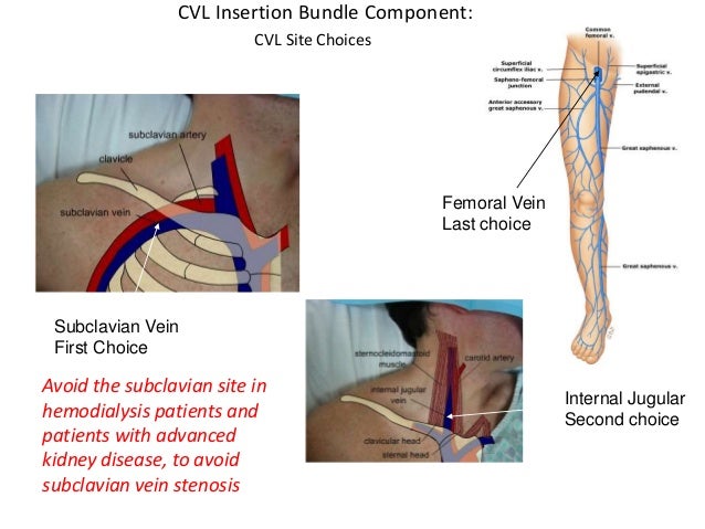 Cabsi cauti-vap-nurses