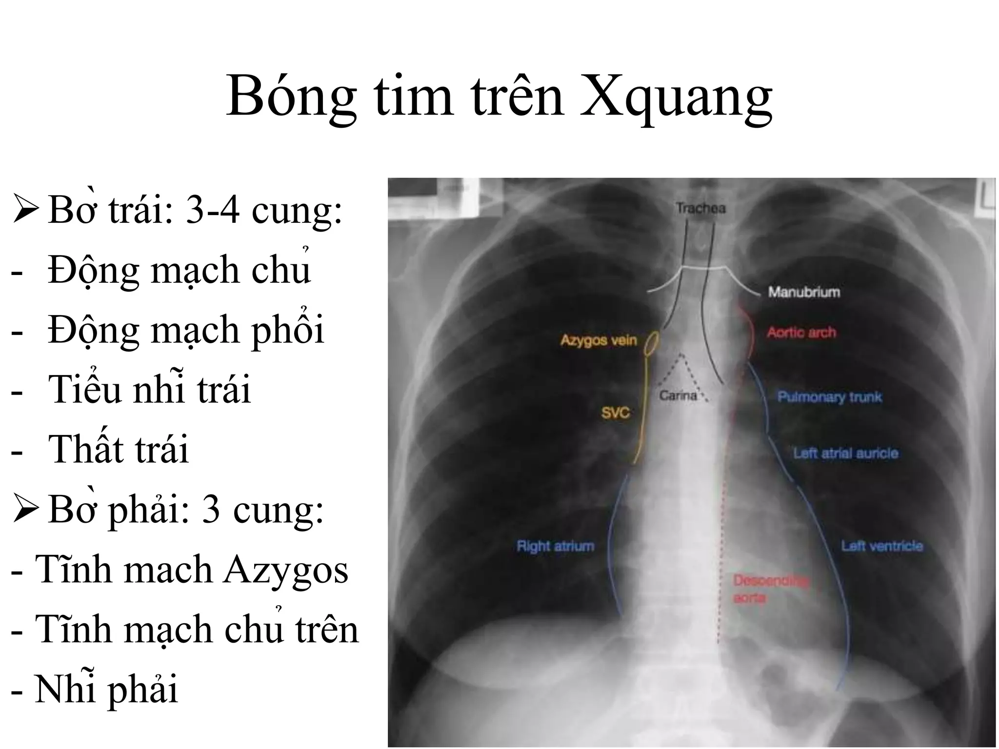Các bất thường bóng tim trên xquang | PPTX