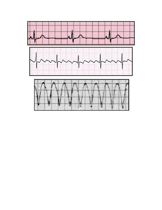 Cac buoc doc ecg | PDF