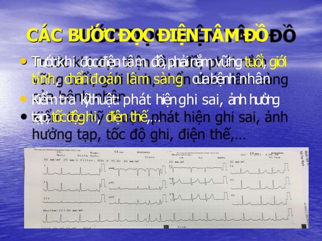 CAC BUOC DOC ECG | PPT