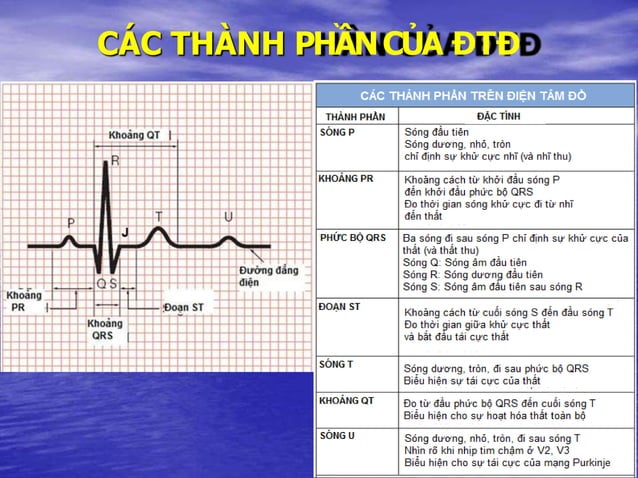 CAC BUOC DOC ECG | PPT