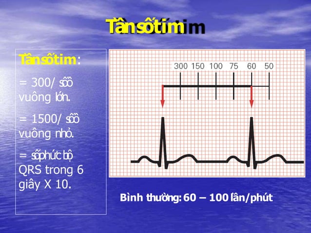 CAC BUOC DOC ECG | PPT