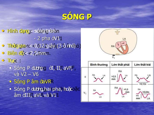CAC BUOC DOC ECG | PPT